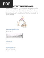 Suboclusion Intestinal | PDF | Enfermedades digestivas | Gastroenterología