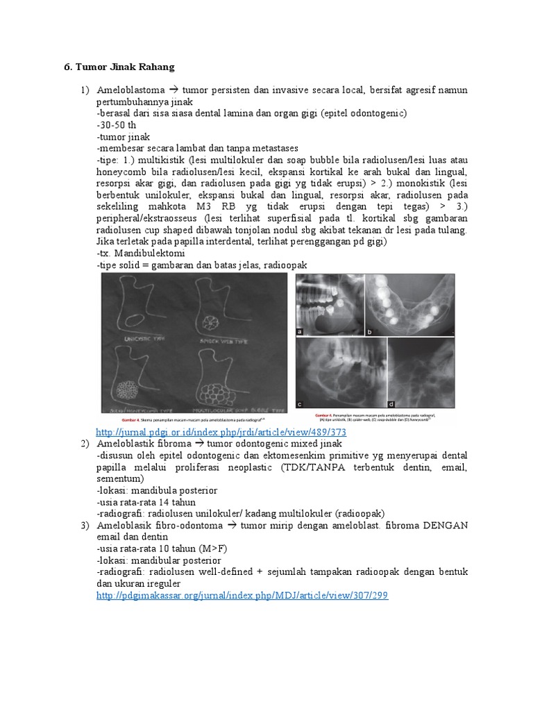 Tumor Jinak Dan Ganas Rahang | PDF