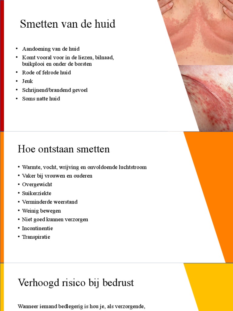 Bedcomplicatie Smetten | PDF