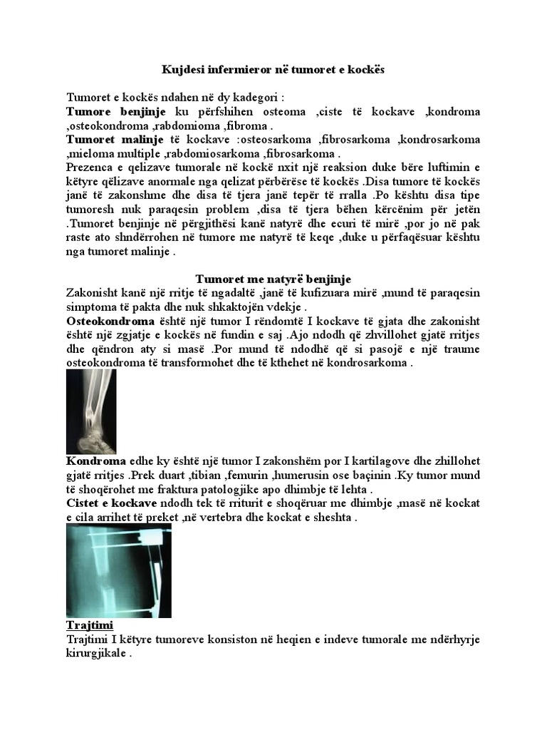Kujdesi Infermieror Në Tumoret e Kockës | PDF