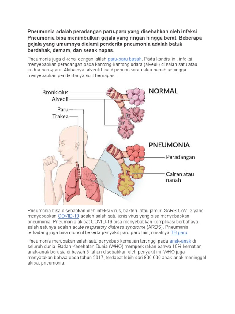 Pnuemonia | PDF | Politik | Perjalanan