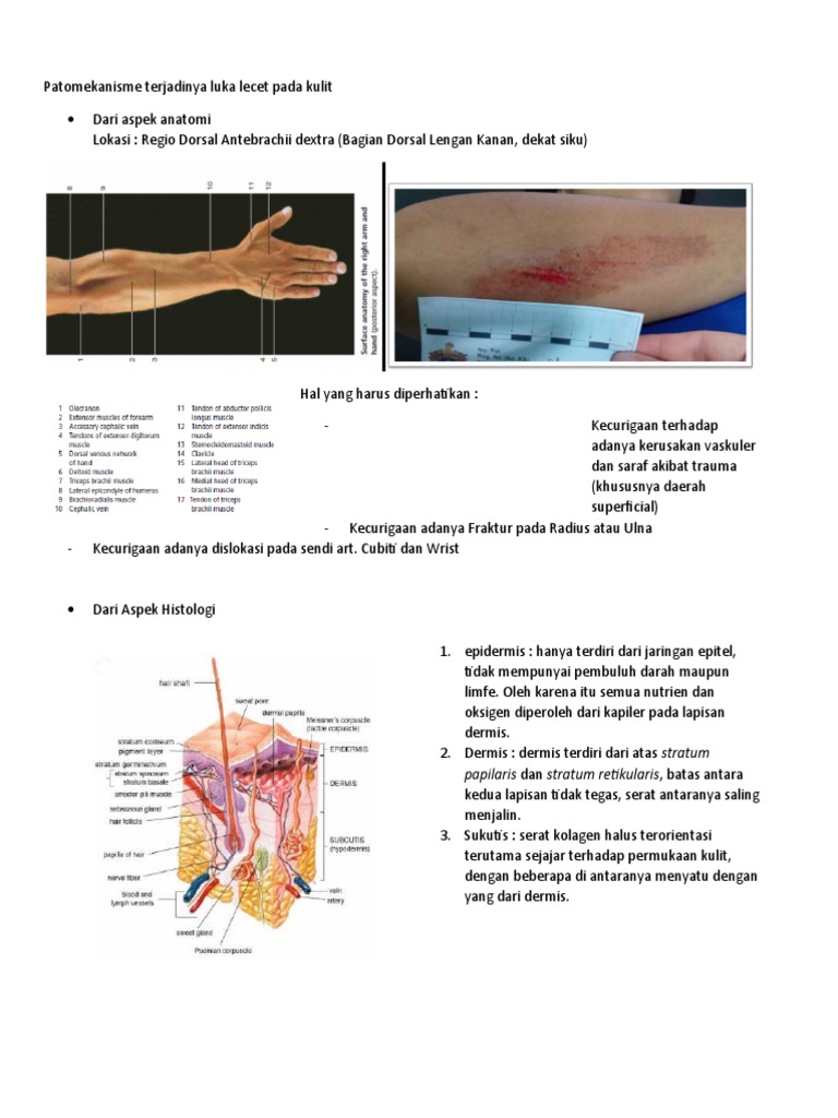 Patomekanisme Terjadinya Luka Lecet Pada Kulit | PDF