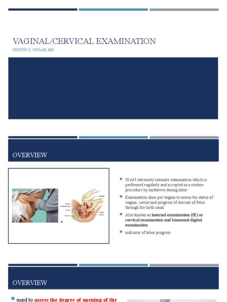 Vaginal/Cervical Examination: Cristin G. Ungab, MN | PDF | Childbirth ...