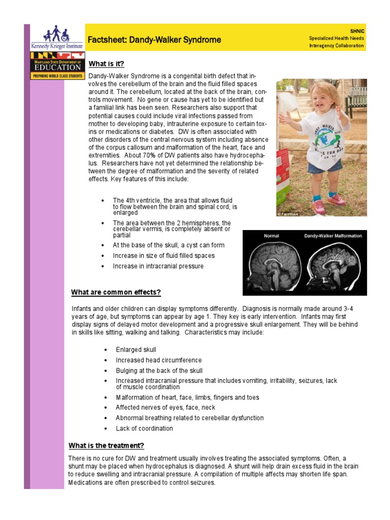 Factsheet: Dandy-Walker Syndrome: What Is It? | PDF | Neuroscience ...