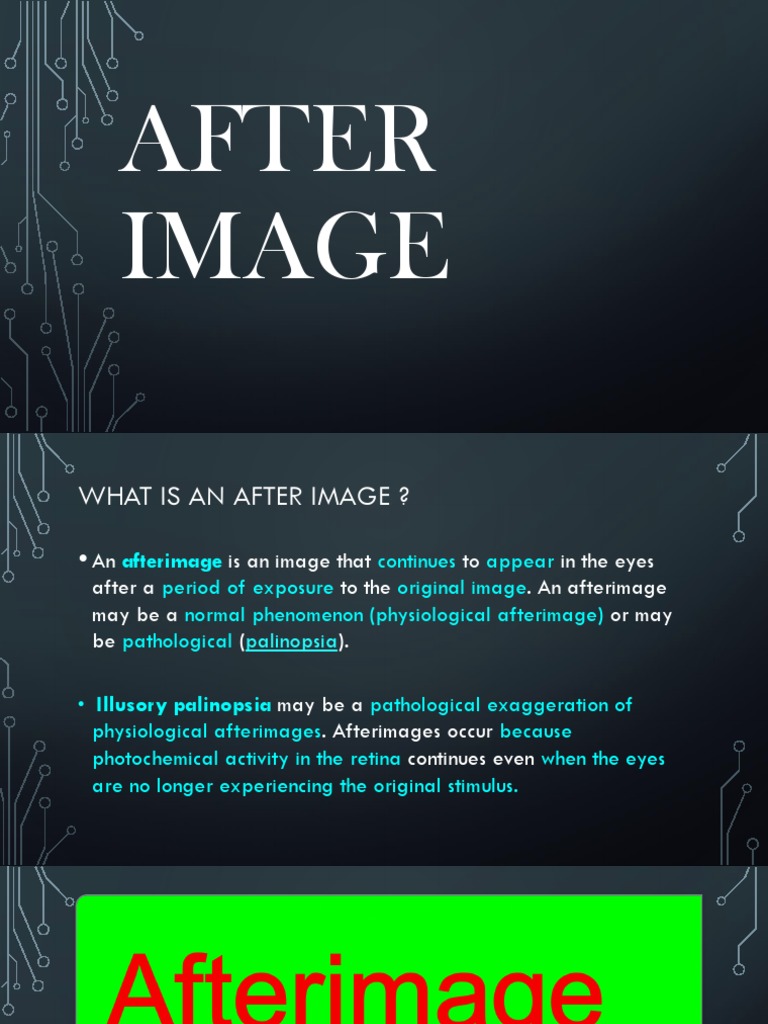 After Image | PDF | Optics | Visual System