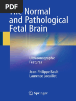 Atlas - of - Hand - Bone - Age, Atlas de Greulich y Pyle | PDF ...