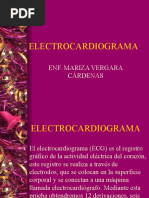 Colocacion de Monitor y Electros | PDF | Electrocardiografia | Presión sanguínea