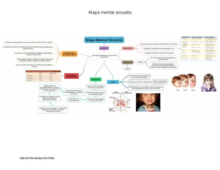 Mapa de Sinusitis | PDF