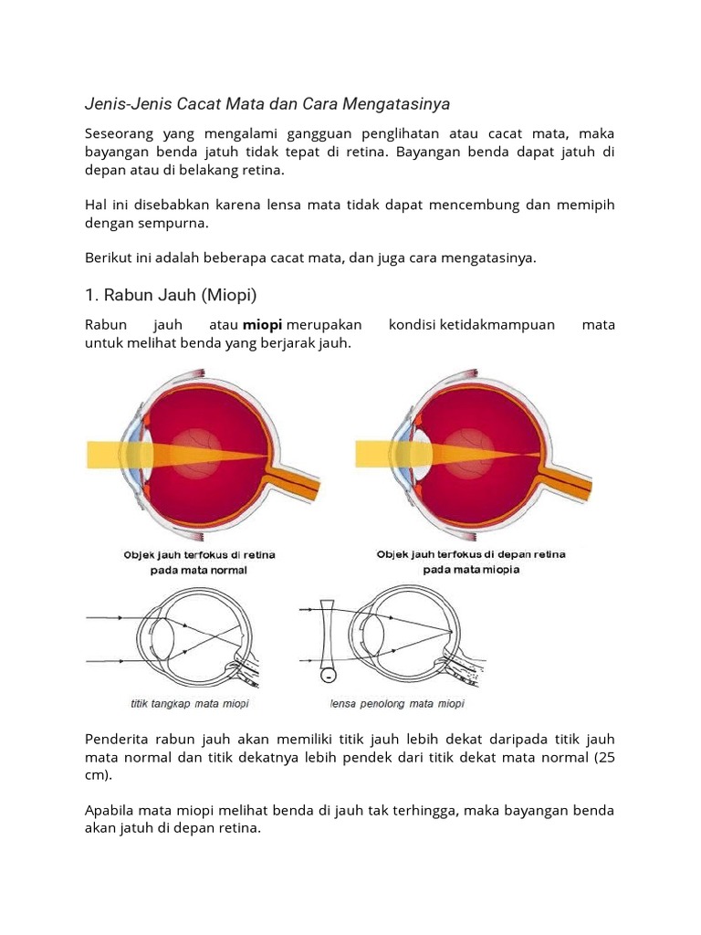Jenis Jenis Cacat Mata Dan Cara Mengatasinya | PDF
