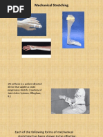 Amputation | PDF | Amputation | Prosthesis