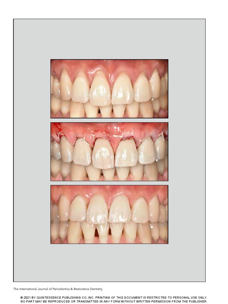 Prognosis 2021 | PDF | Periodontology | Dentistry