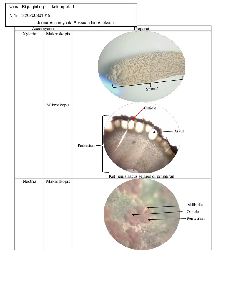 Struktur dan Reproduksi Ascomycota | PDF | Sains & Matematika