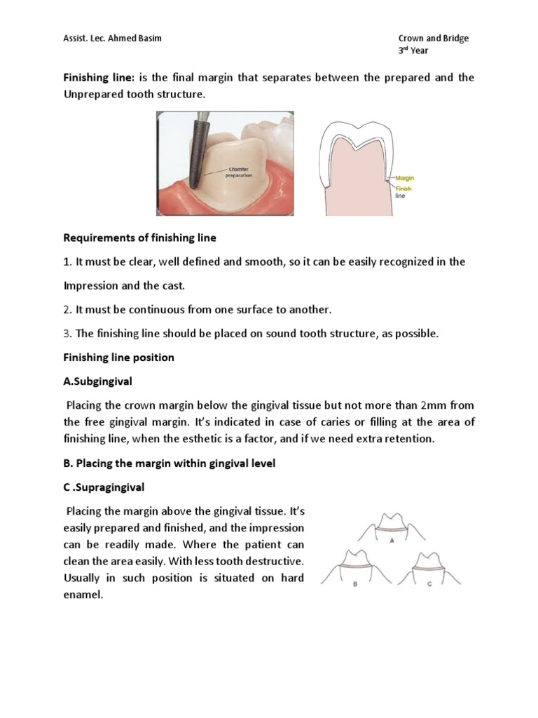 Dental Crown Finishing Lines Guide | PDF | Health Sciences | Dentistry ...