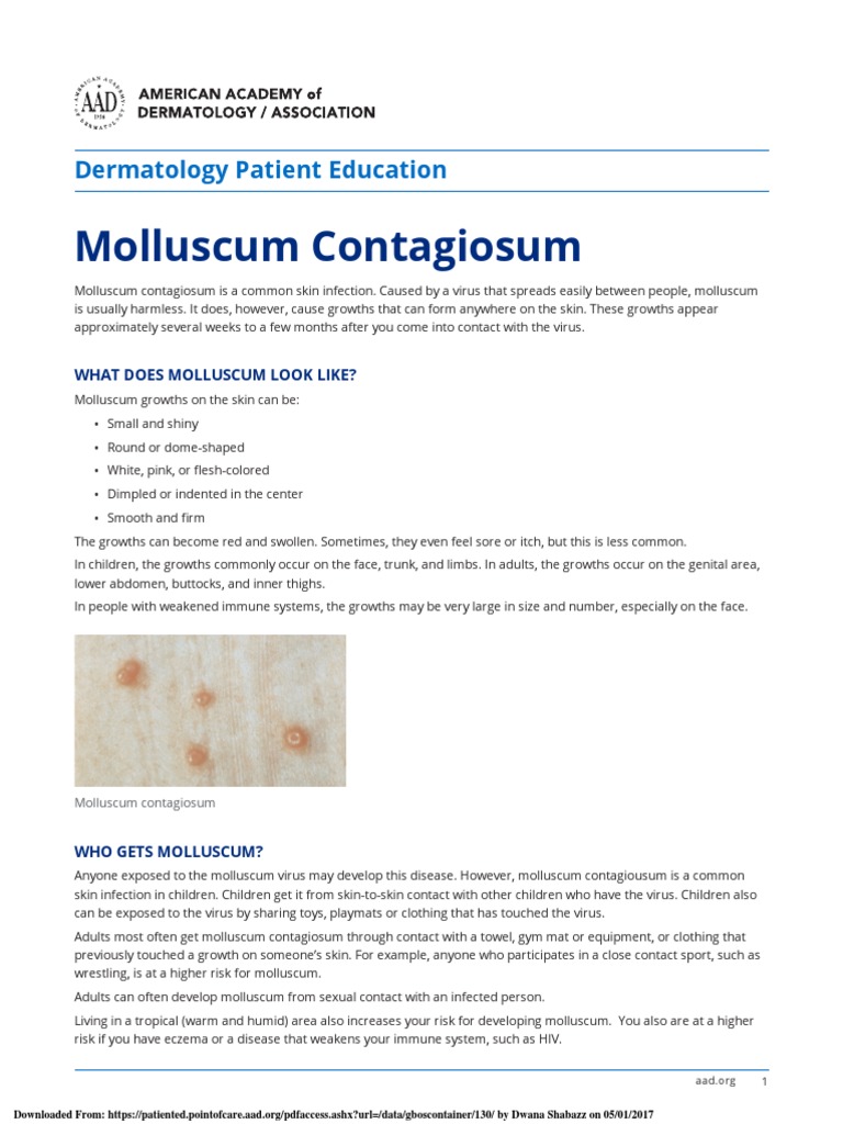 Molluscum Contagiosum | PDF | Dermatology | Clinical Medicine