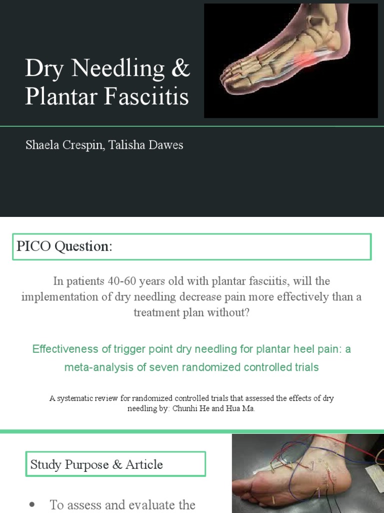 Dry Needling Plantar Fasciitis 1 | PDF | Myofascial Trigger Point ...
