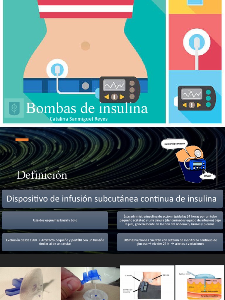 Guía sobre Bombas de Insulina | PDF | Hipoglucemia | Diabetes