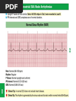 ECG Arrhythmias: PAC, PJC, PVC Guide | PDF | Cardiac Electrophysiology ...