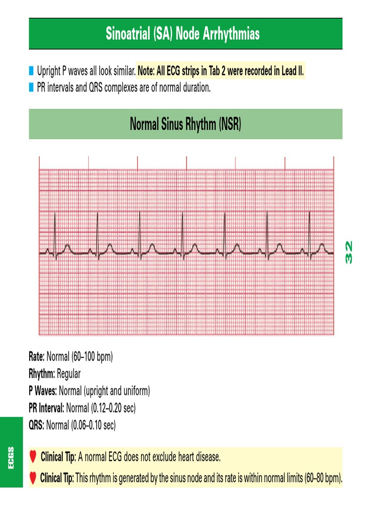 Ecg Strips | PDF | Electrocardiography | Medical Specialties