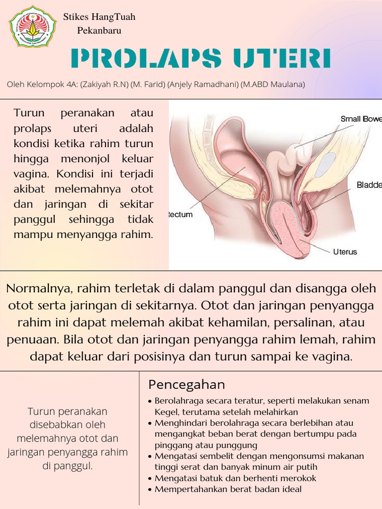 Prolaps Uteri | PDF