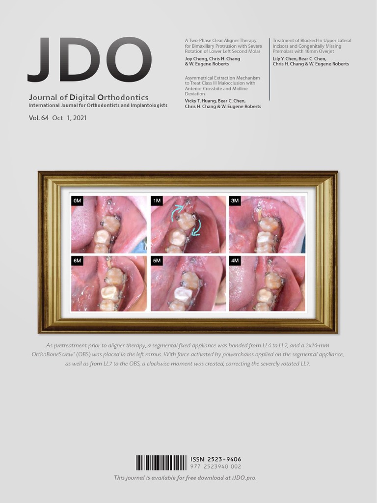 Jdo Vol 64 Updated | Download Free PDF | Orthodontics | Face
