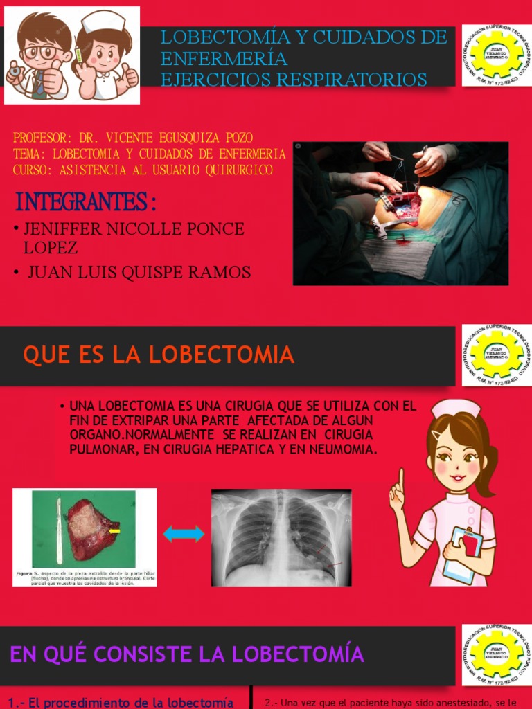 LOBECTOMIA | PDF | Pulmón | Sistema respiratorio