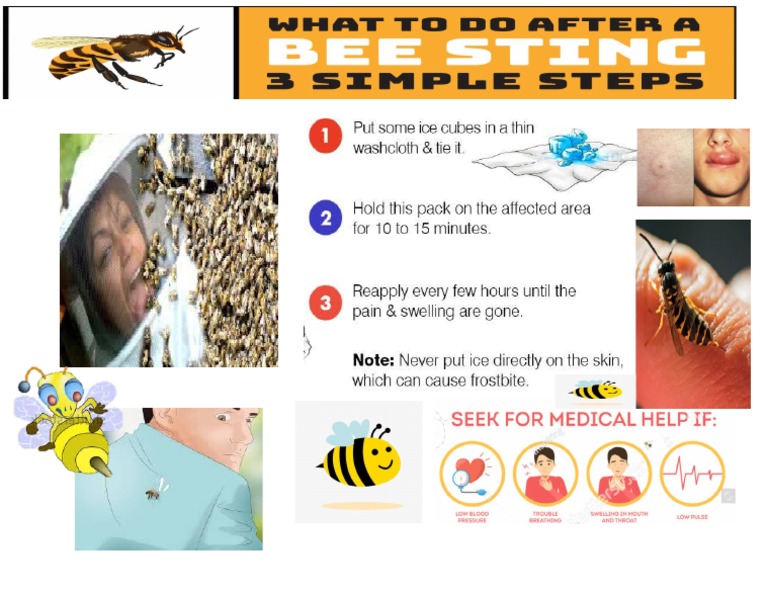 Bee Sting Infographic | PDF