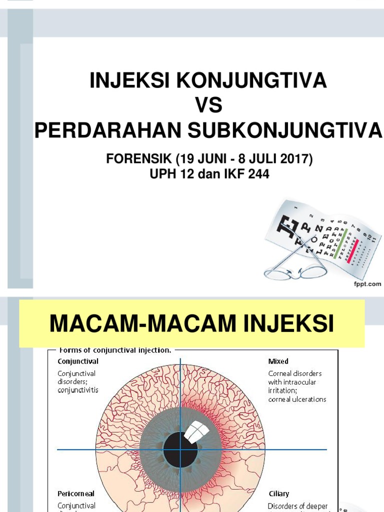 Injeksi vs Perdarahan Konjungtiva | PDF