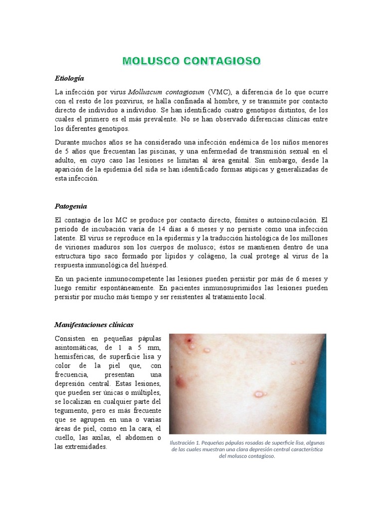 Molusco Contagioso: Causas y Tratamientos | PDF | Medicina CLINICA ...