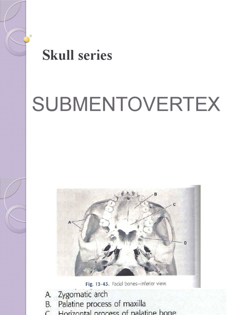 Submentovertex View Positioning Guide | PDF | Science & Mathematics