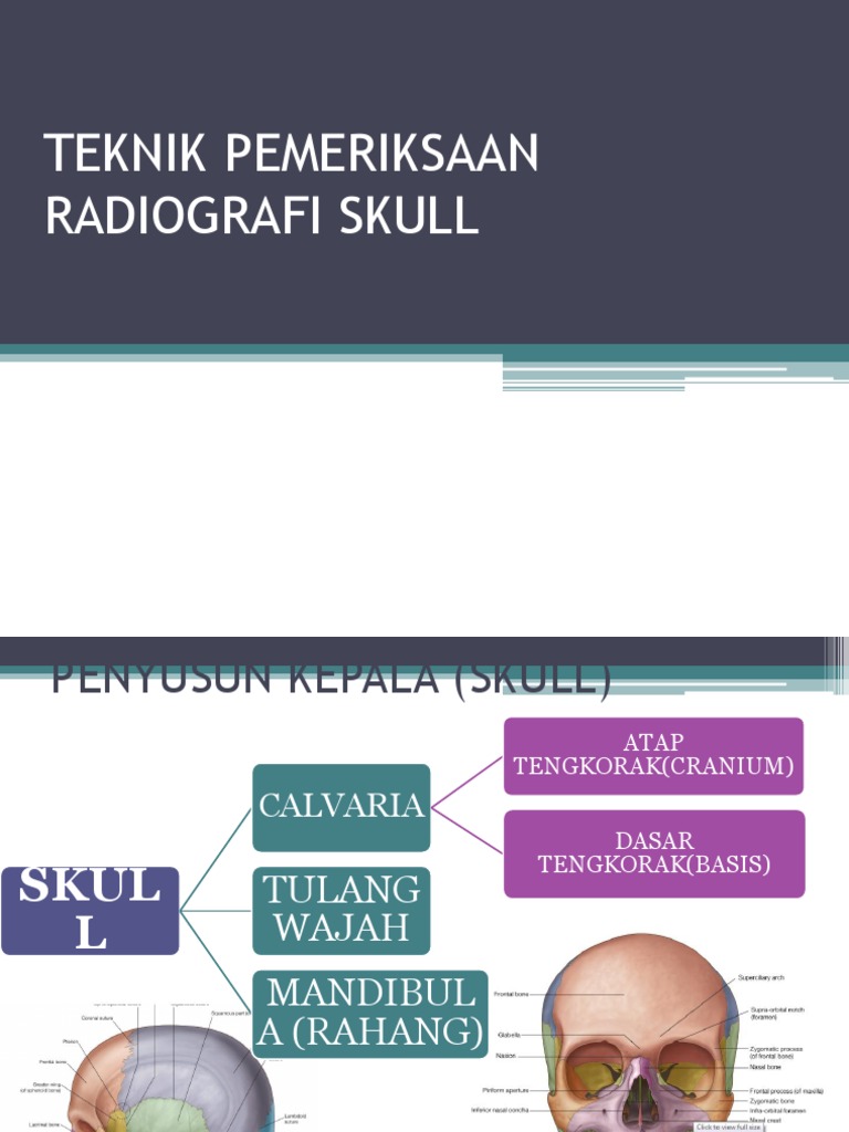 Teknik Pemeriksaan Radiografi Skull 1 | PDF