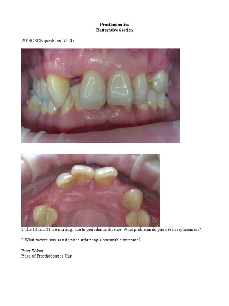 Scenerio Based Q-Prostho | PDF | Dental Implant | Dentures