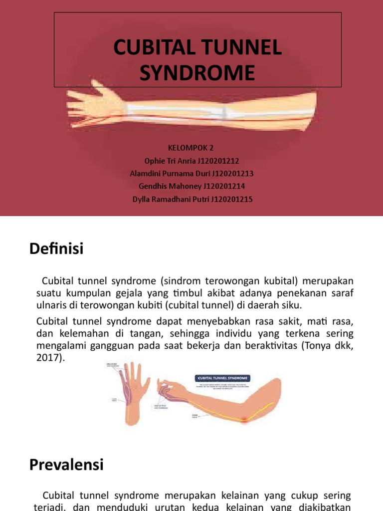 Cubital Tunnel Syndrome | PDF