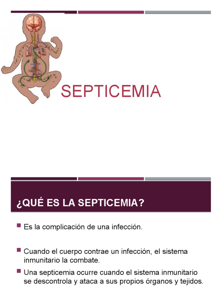 Septicemia | PDF | Septicemia | Infección