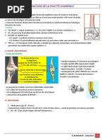 Chapitre 6 - Fractures Du Cotyle | PDF | Orthopédie | Médecine clinique