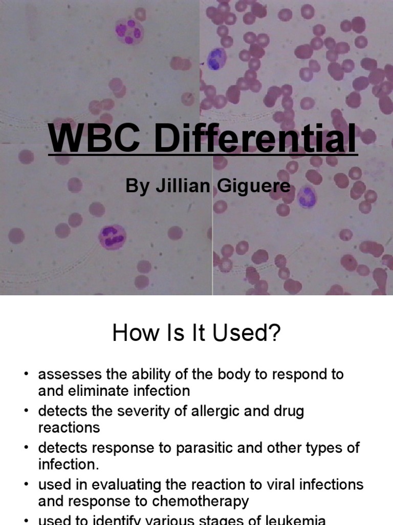 A Comprehensive Guide to the White Blood Cell Differential: Cell ...