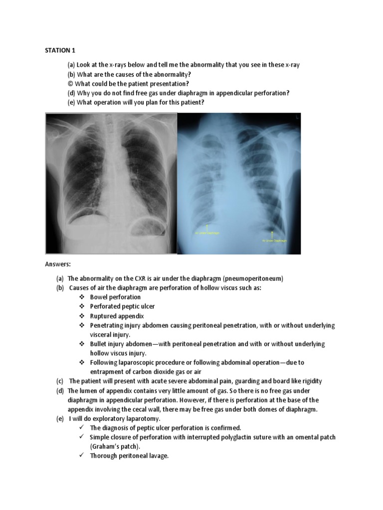 Don Kachi Surg | PDF | Cerebrospinal Fluid | Burn