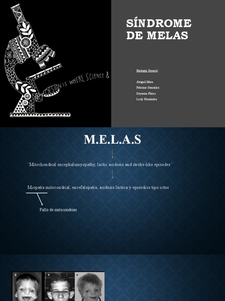 Síndrome de MELAS | PDF
