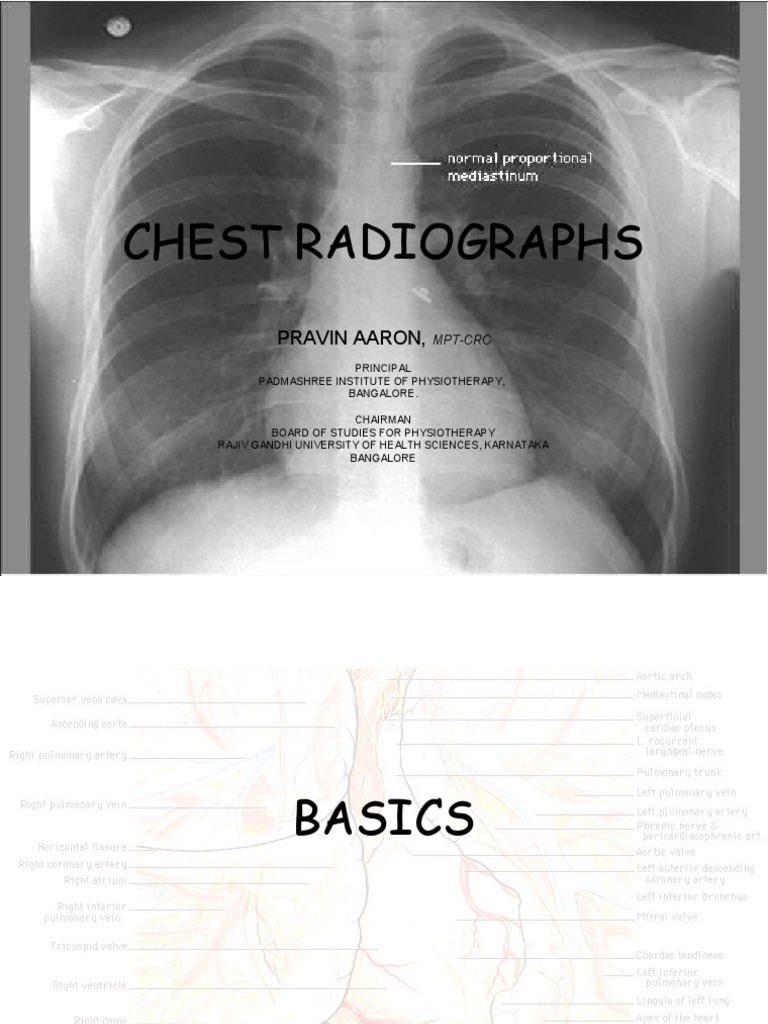 Chest Radio Graphs 2 | PDF | Lung | Atrium (Heart)
