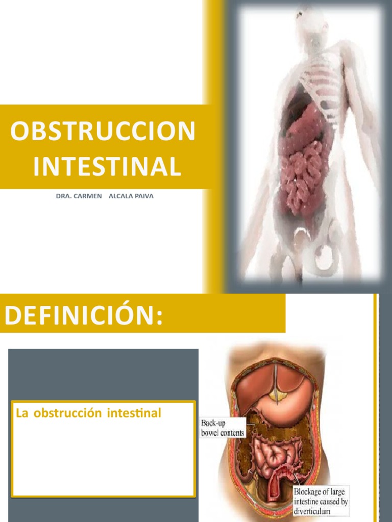 Obstrucción Intestinal: Causas y Síntomas | PDF | Especialidades ...