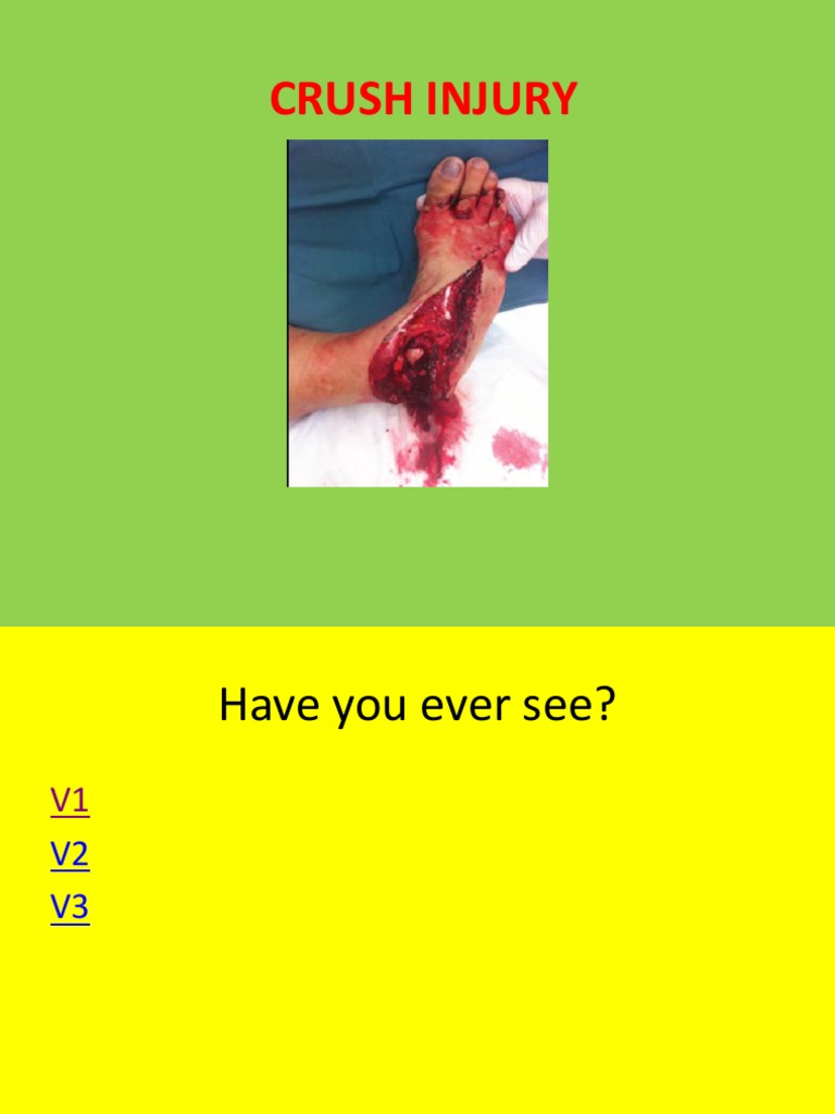 Crush Injury | PDF | Sains & Matematika