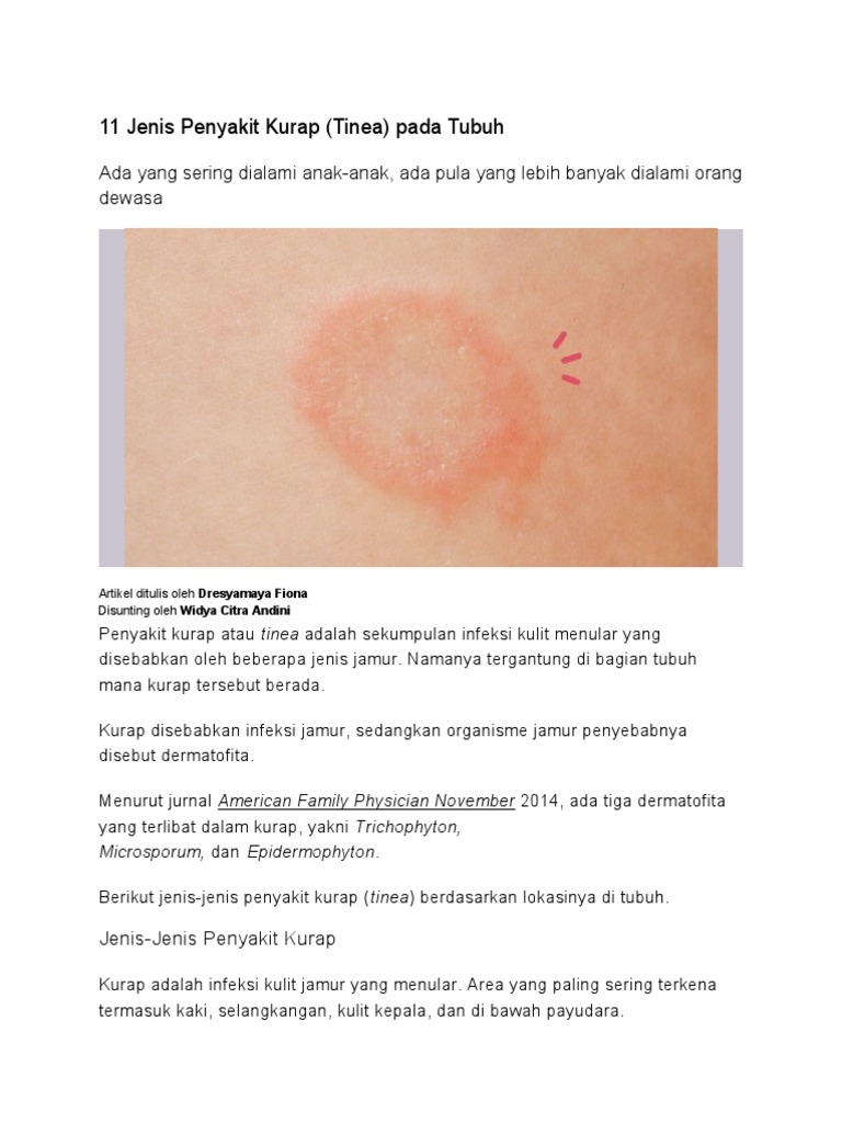 11 Jenis Penyakit Kurap | PDF