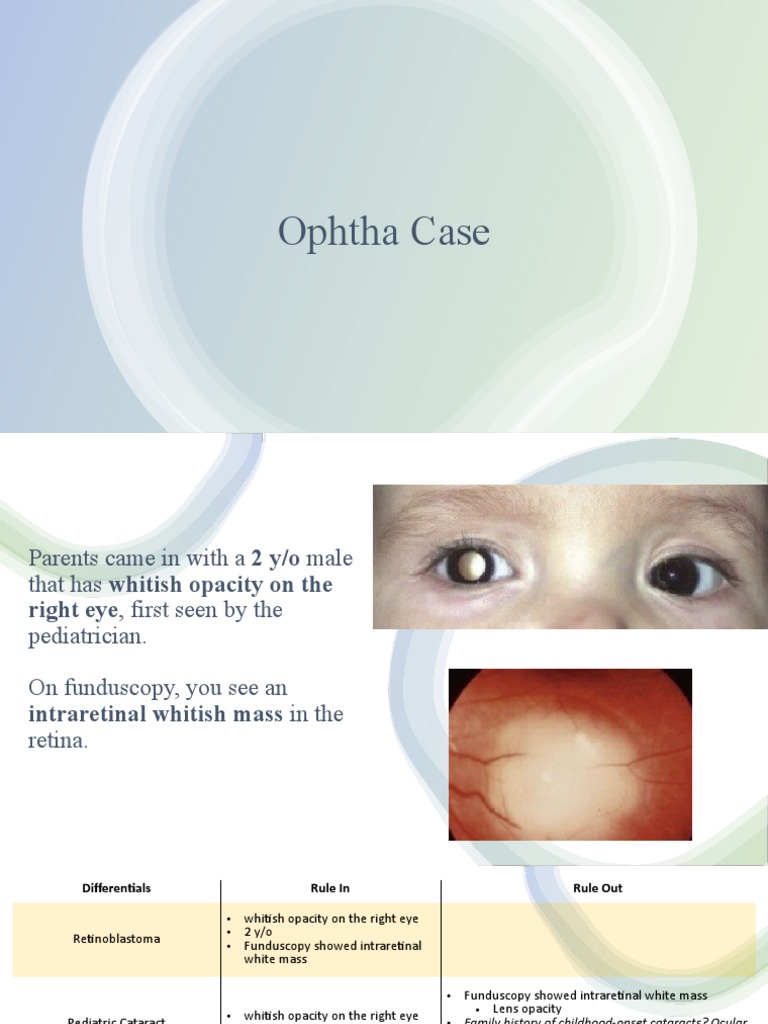 Ophtha Case | PDF | Radiation Therapy | Cataract