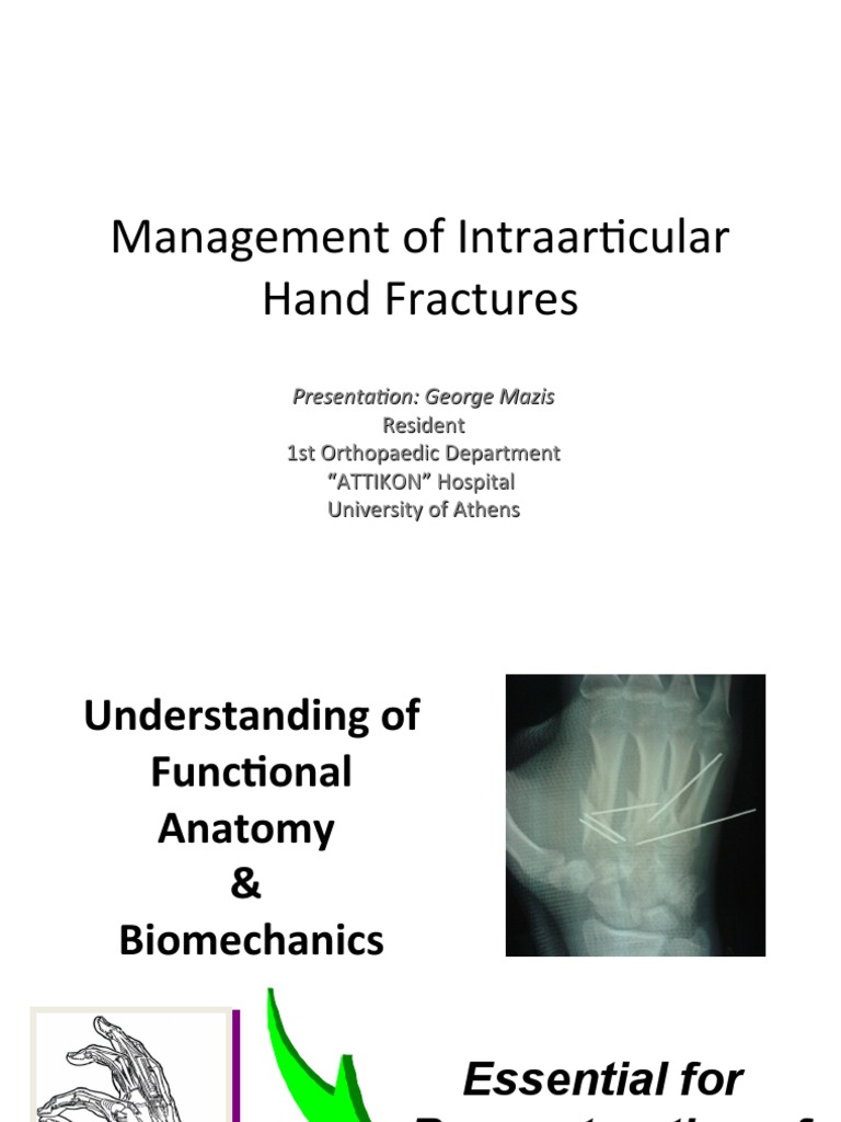 Management of Intraarticular Hand Fractures | PDF | Traumatology | Hand