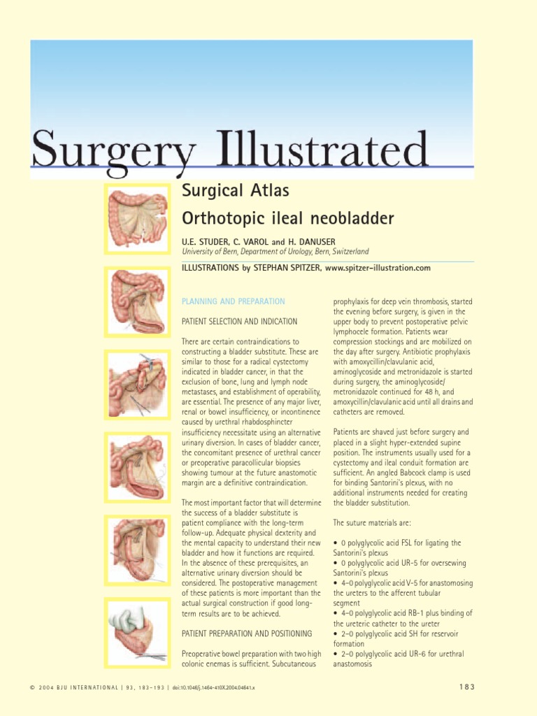 Studer Surgical - Images - of - Ileal - Conduit | PDF | Urinary ...