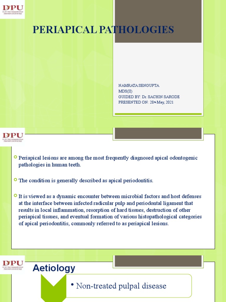 Periapical Pathologies: Namrata Sengupta Mds (Ii) Guided By: Dr. Sachin ...
