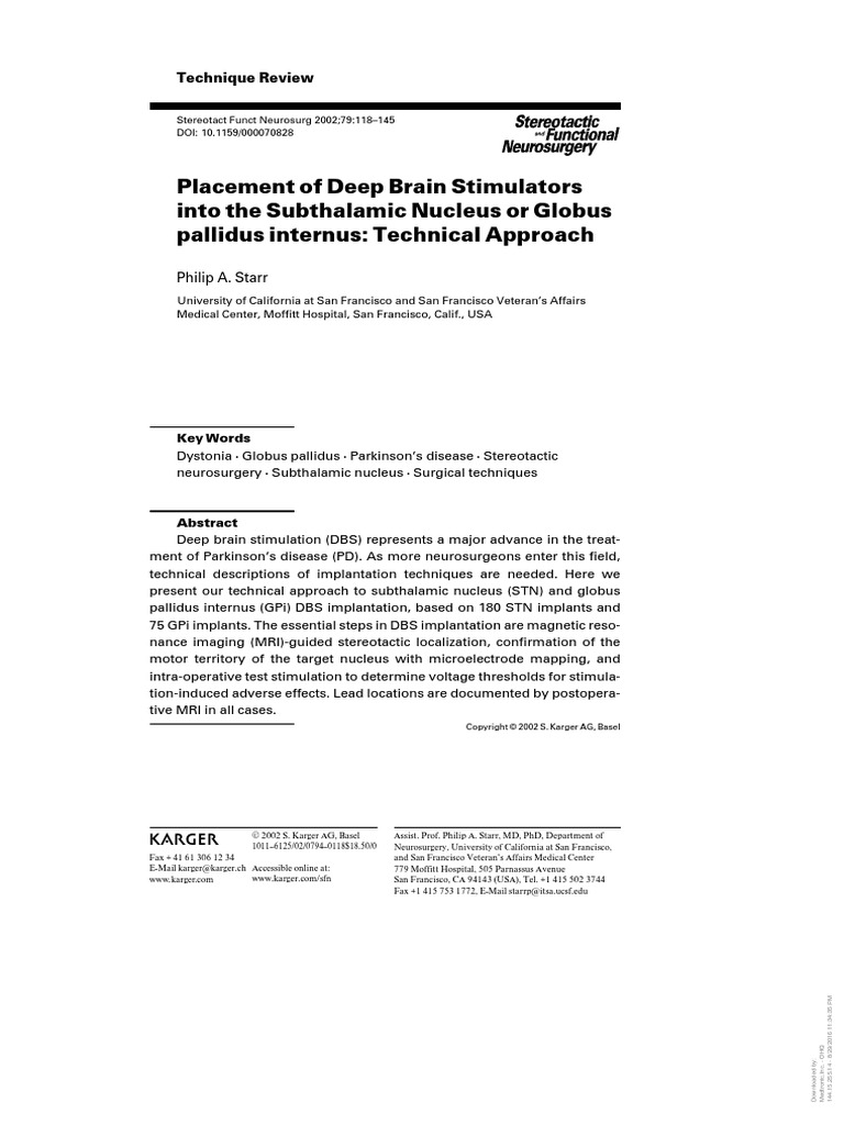 Starr PA. Placement of Deep Brain Stimulators Into The STN and GPI ...