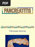 Criterios de Ranson en Pancreatitis Aguda 1 | PDF