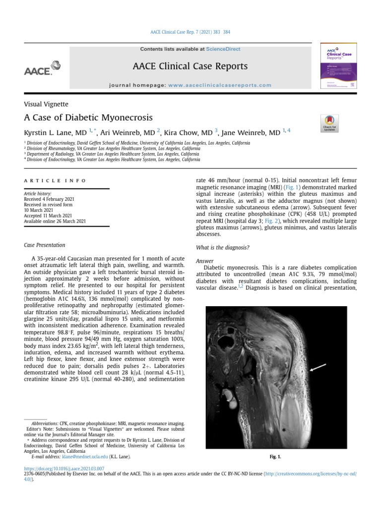 AACE Clinical Case Reports: Kyrstin L. Lane, MD, Ari Weinreb, MD, Kira ...