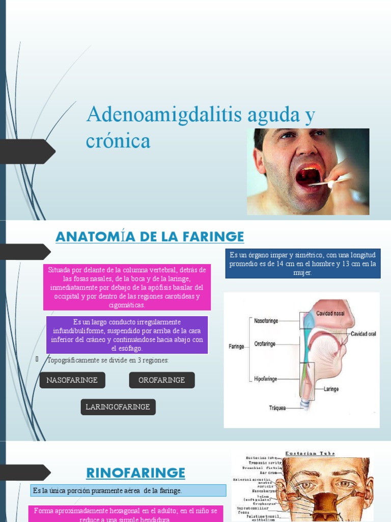 Adenoamigdalitis Aguda y Cronica | PDF | Enfermedades y trastornos ...
