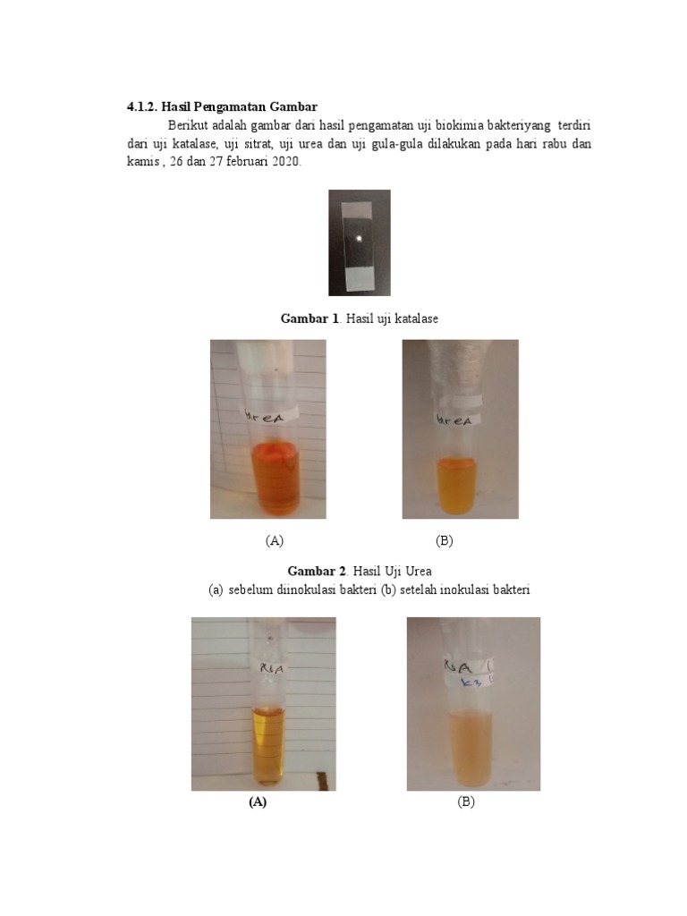 Hasil Pengamatan Uji Biokimia Bakteri | PDF